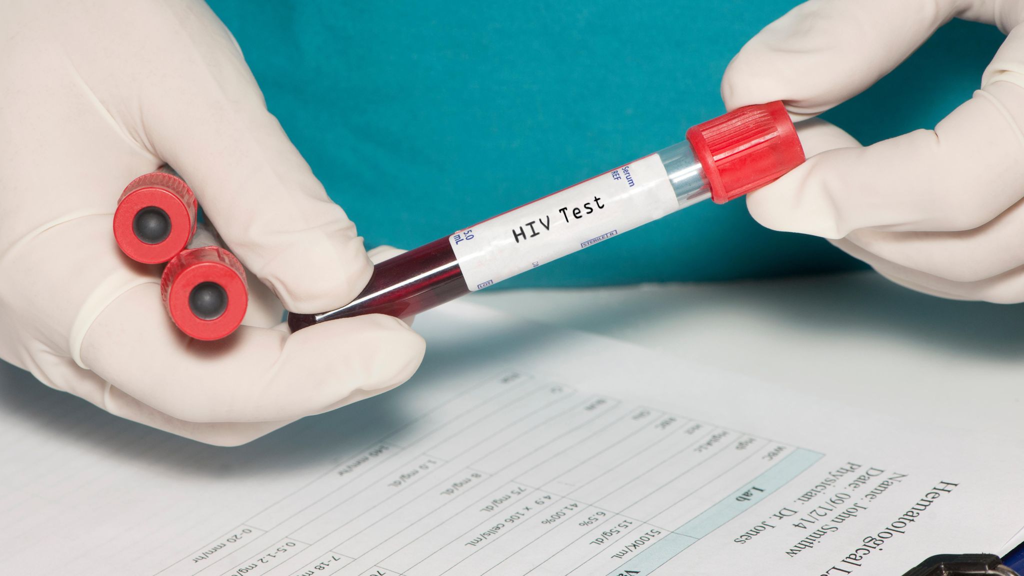 Kenya Red cross partners with CONPHAK to reduce HIV infections in Kwale ...